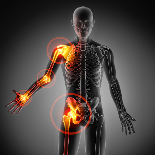 Rheuma: Symptome und Ursachen! - Medizin Heute Online